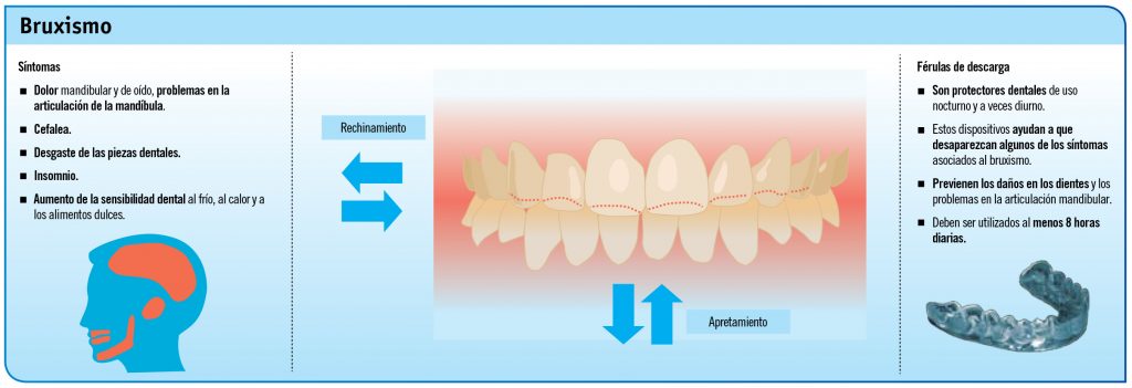 Bruxismo, el hábito de apretar los dientes