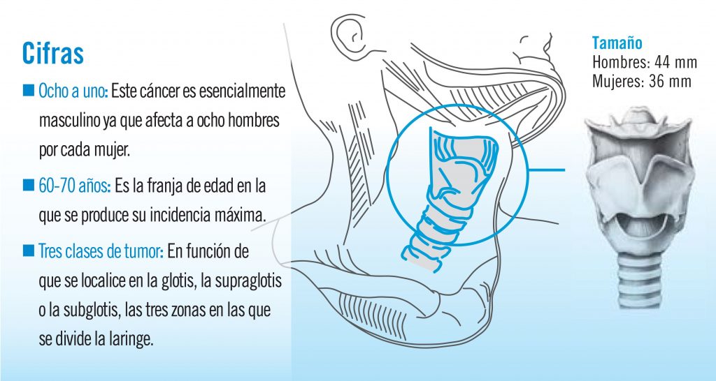 Cáncer de laringe: síntomas y tratamiento