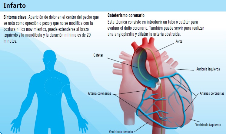 Un corazón sin riesgo de infarto