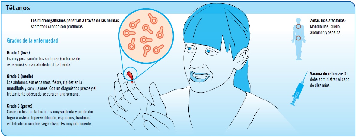 Tétanos, la importancia de estar vacunado